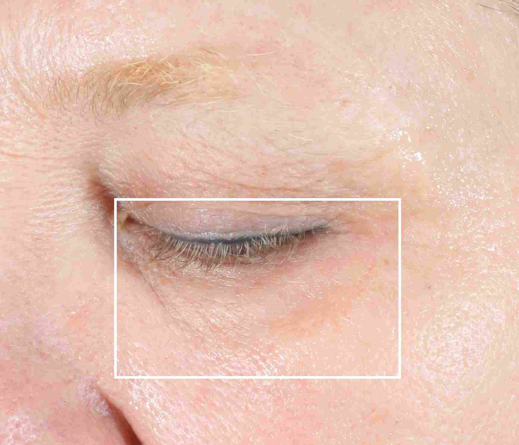 Shop NuFACE Fix Line Smoothing Device Online in UAE