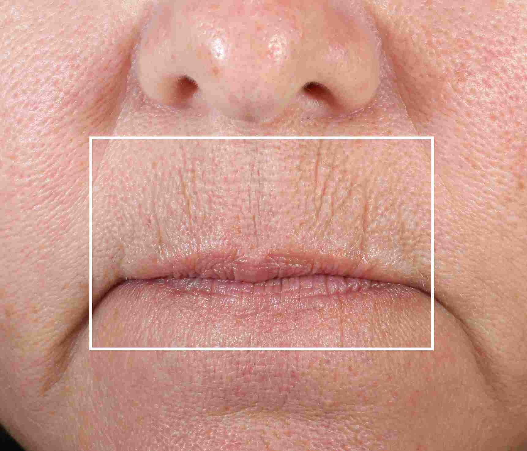 Shop NuFACE Fix Line Smoothing Device Online in UAE