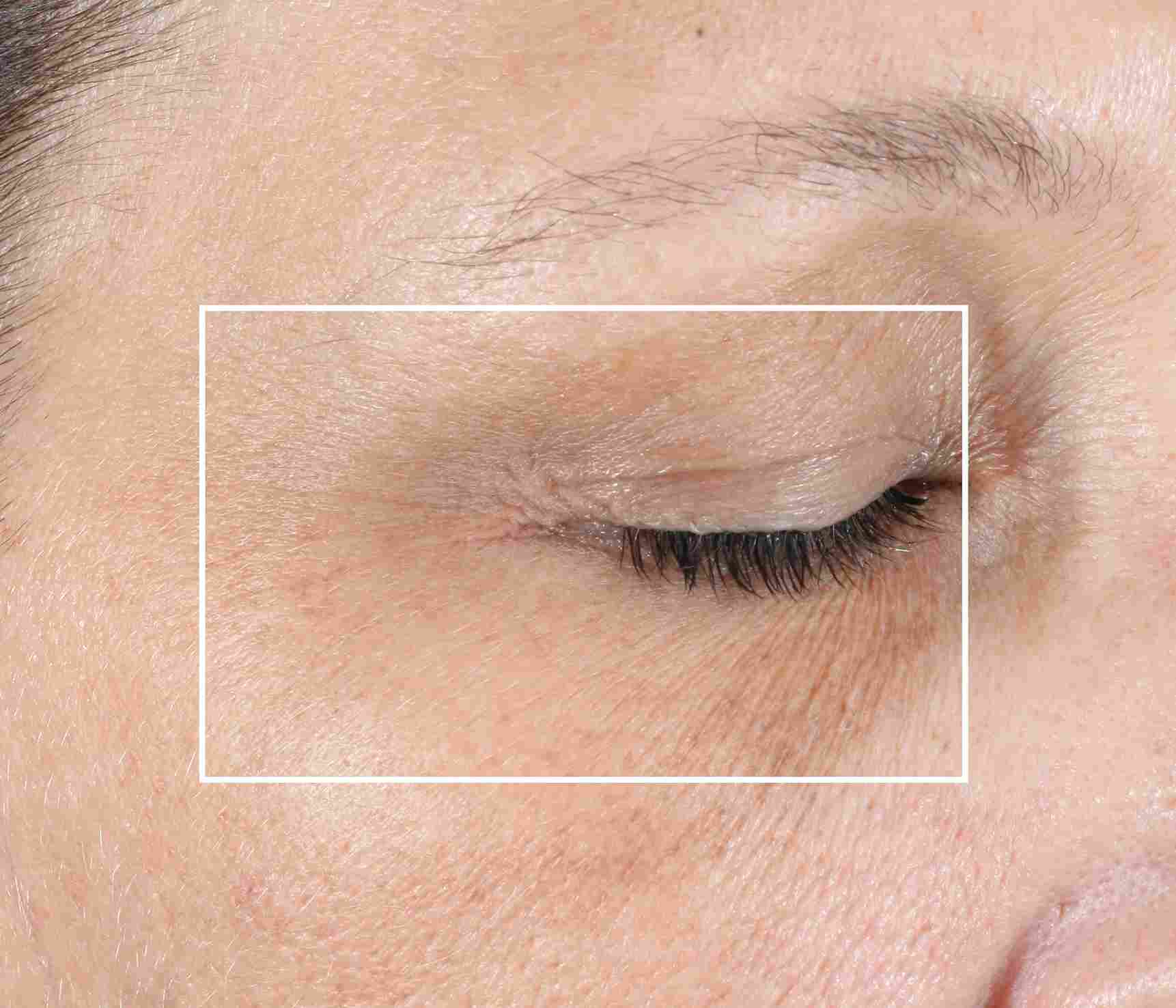Shop NuFACE Fix Line Smoothing Device Online in UAE